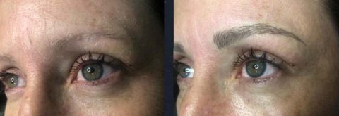 Microblading | La Derma | Dermal Aesthetics | Ballito | The Well | KZN ...
